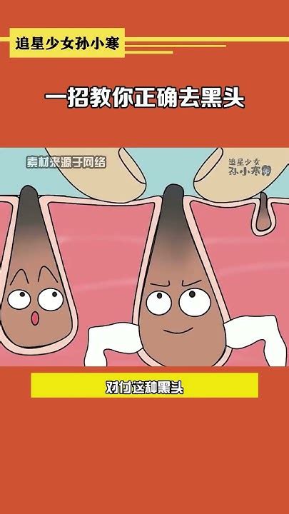 一招教你去黑頭！ 跟黑頭說拜拜！ Youtube