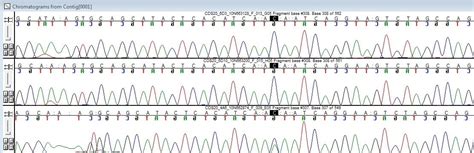 Mutation Screening Of SCN A In Schizophrenia And Identification Of A