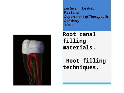 Ppt Root Canal Filling Materials Root Filling Techniques Lecturer
