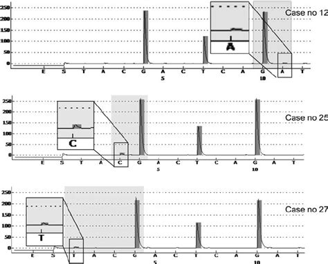 Mutation Analysis Of Kras Codons 12 13 Using Pyrosequencing Mutation