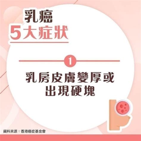 癌症殺手｜台灣歌后江蕙突揭患癌 醫生揭2大警訊：盼她撐過這一關