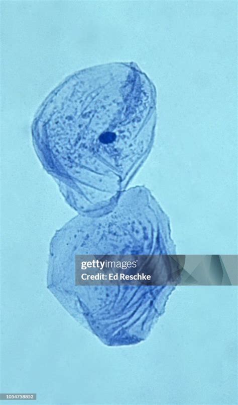 Human Epithelial Cells 100x