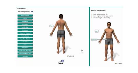 Sunrise Epr Altera Digital Health United Kingdom