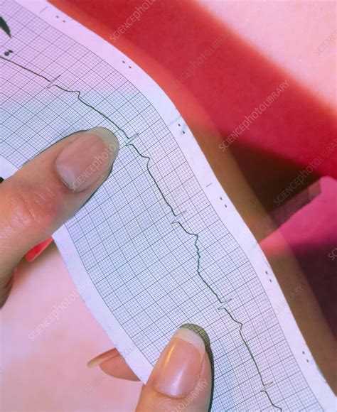 Ecg Printout Stock Image P2160350 Science Photo Library
