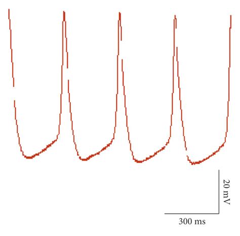 Electrophysiological Effects Of Propofol On Sinoatrial Node Pacemaker