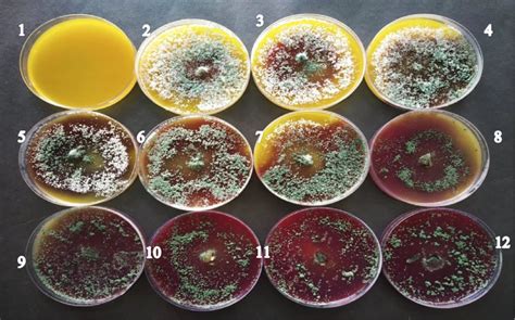 Screening Of Trichoderma Isolates For Chitinase Activity On Medium Download Scientific Diagram