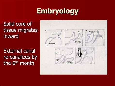 Ppt Congenital Aural Atresia Powerpoint Presentation Free Download