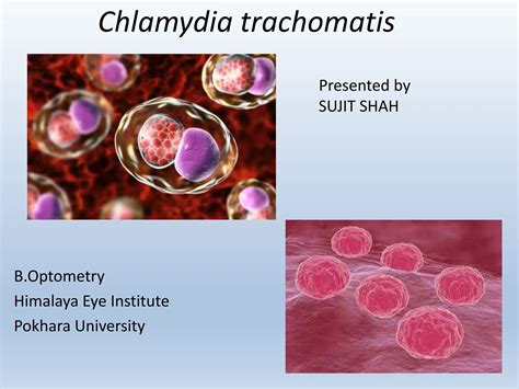 Chlamydia Trachomatispptx Microbiology Ppt