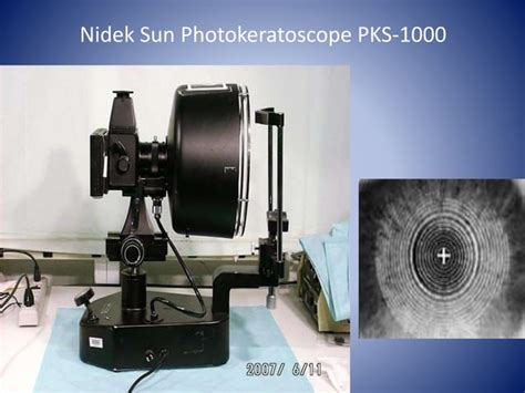 Corneal Topography Final Pptx