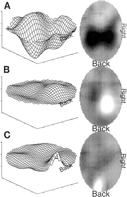 Each Image Shown On Left Is A Wire Frame Plot Where Magnitude Of