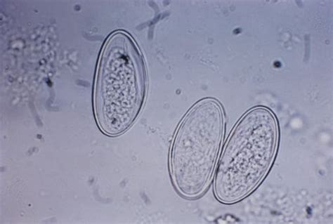 Huevos De Enterobius Vermicularis
