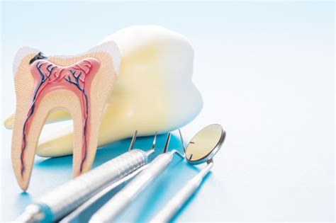 Endodontia Entenda O Tratamento De Canal Uniodonto Uberlândia