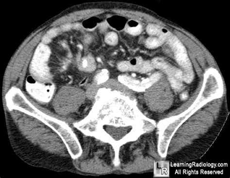 Welcome To Learningradiology