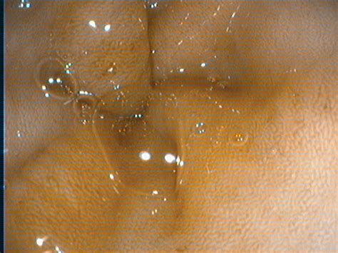 Gastrointestinal Endoscopy Metro Vet