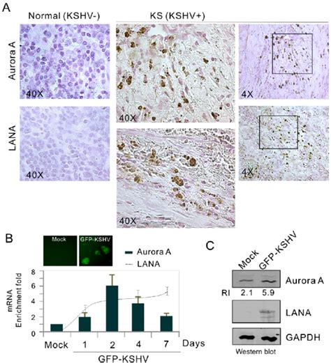 Aurora A Expression Is Up Regulated In Kshv Latently Infected Cells