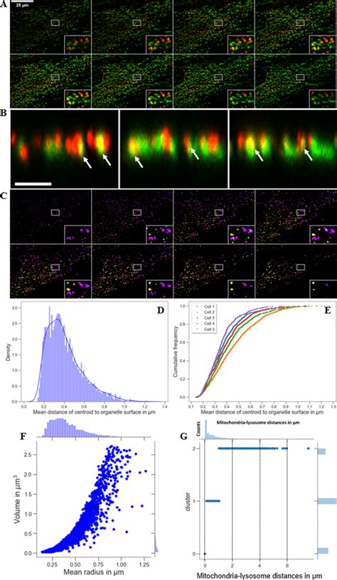 Centroid Based 3d Quantification Of Distances Between Lelyss Download Scientific Diagram