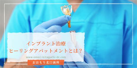 インプラント治療ヒーリングアバットメントとは？ 大森北口歯科様