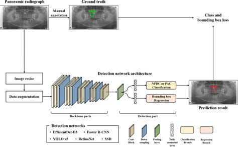 Automatic Detection And Classification Of Nasopalatine Duct Cyst And Periapical Cyst On
