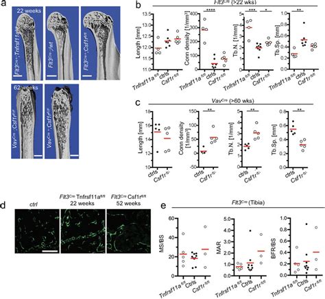 Bone Histomorphometry In Aged Flt3cretnfrsf11aflfl Download Scientific Diagram