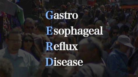 Health Beat Gerd Nerd 5 Acid Reflux Myths Health