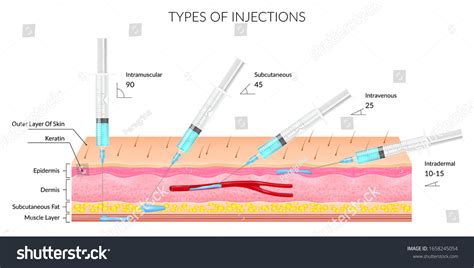 Structural Injection Images Stock Photos Vectors Shutterstock