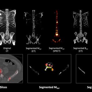 Examples Of The Segmentation Output Three Dimensional Maximum