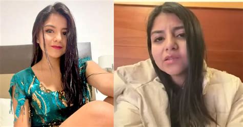 Así luce Nickol Sinchi luego de sufrir parálisis facial por ataque de ansiedad Infobae