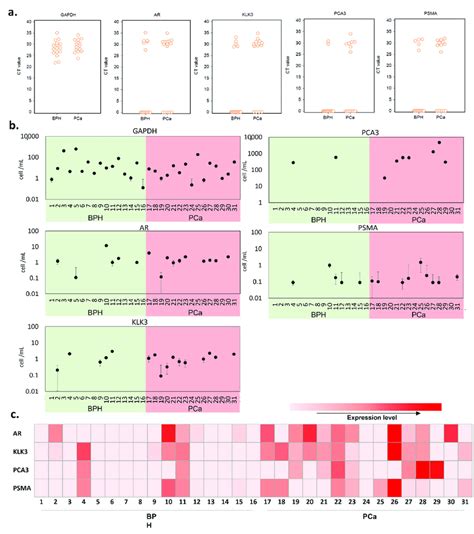 Qrt Pcr Analysis In Bph And Pca Patient Urine Samples A Interactive
