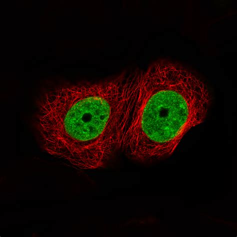 Mouse Monoclonal Anti Atad2 Antibody Buy For Research Highly