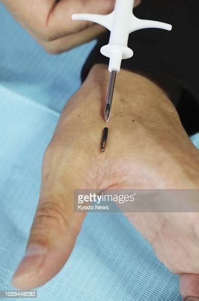 Photo Taken On July 23 Shows A Microchip And The Needle Used To News