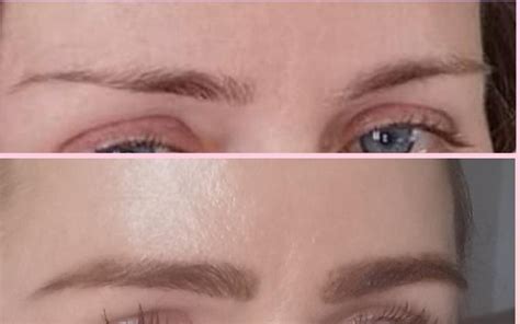 Happy Post Welcome Back Eyebrows Thyroid Uk