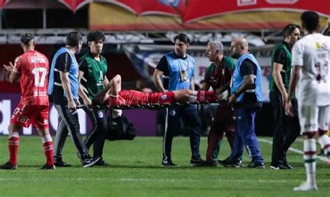 El Diagnóstico De La Grave Lesión Del Jugador De Argentinos La Brújula 24