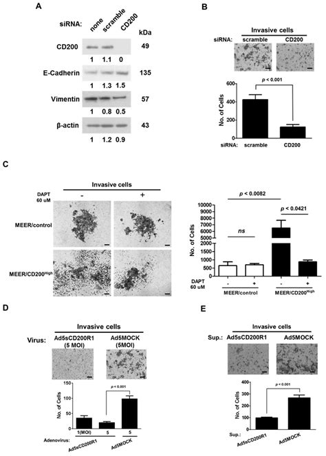 Inhibition Of Cd200 Lowered Emt Related Gene Expression And Reduced
