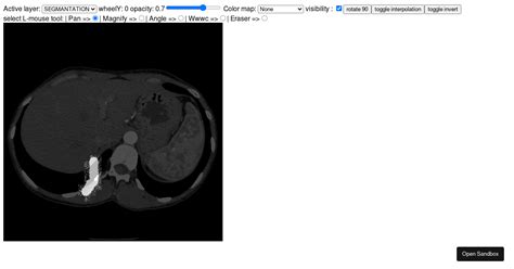 Cornerstone React Example Forked Codesandbox