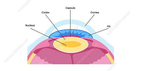 Lens Capsule Cortex Diagram Basics Of Lens For Ophthalmology Board