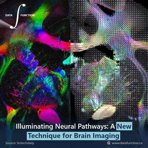 Data Function Inc On Linkedin Datafunction Brainmapping