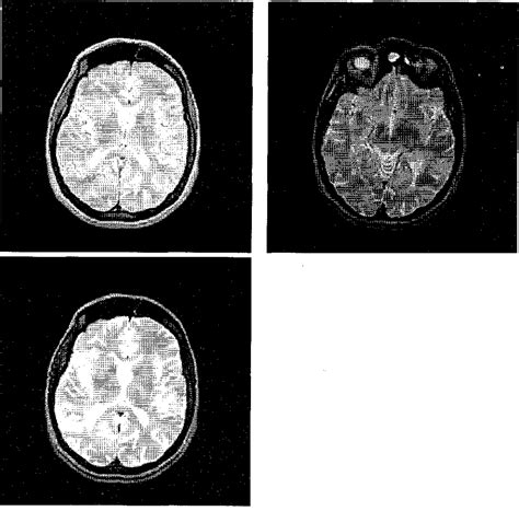 Pdf Extension Of The Icp Algorithm To Non Rigid Intensity Based Registration Of 3d Volumes