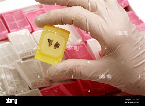Wax Prepared Pathology Specimens Person Holding One Of A Number Of Pathology Specimens In Wax