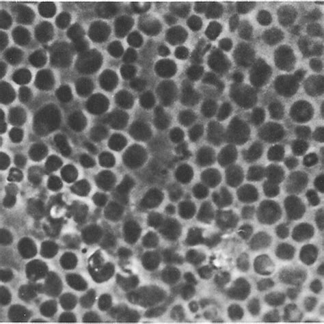 A Light Micrograph Of Isolated Acanthamoeba Nucleoli Note The Presence