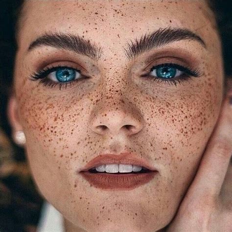 Github Dungviet112freckles Classify Between Freckled Face And None Freckle Face