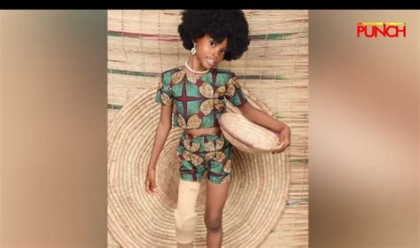 10 Year Old Amputee Dreams Of Becoming A Model