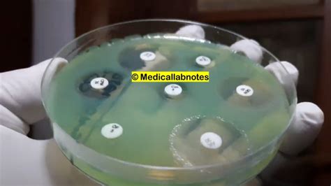 Pseudomonas Aeruginosa Introduction Morphology Pathogenicity