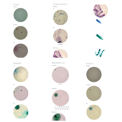 Solved Eukaryotes Disease Caused Kingdom Subkingdom Phylum