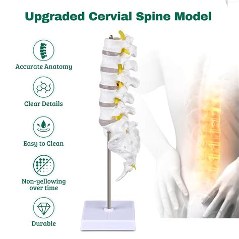 Ultrassist Modelo De Columna Vertebral Humana Con V Rtebras Lumbares Herniaci N Nervios