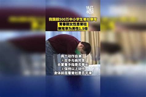1月12日据央视新闻报道，我国超500万中小学生脊柱侧弯我国
