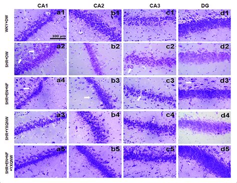 Yxqnw Protects The Neuron Structure In Ca1 Ca2 Ca3 And Dg Regions