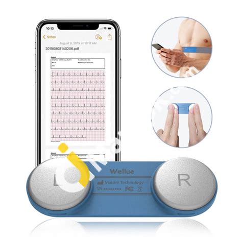 Wellue Duoek™ Portable Ekg Monitor Wellue Heart Monitor Bluetooth H