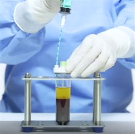 骨一科丨富血小板血浆（prp） 特色技术 安徽医学高等专科学校附属医院（安徽省第二人民医院）、安徽省眼科医院、安徽省职业病防治院