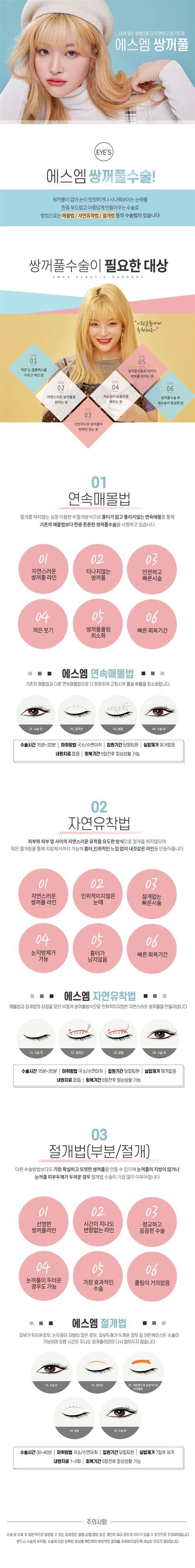 쌍꺼풀수술 에스엠sm성형외과의원