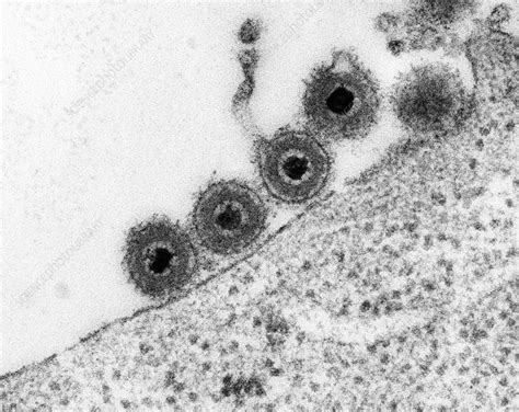 Herpes Virus Electron Microscope